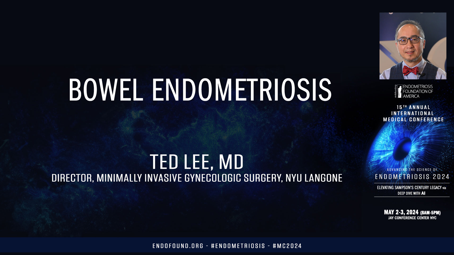 Bowel Endometriosis - Ted Lee, MD | EndoFound Bowel Endometriosis - Ted Lee, MD | EndoFound