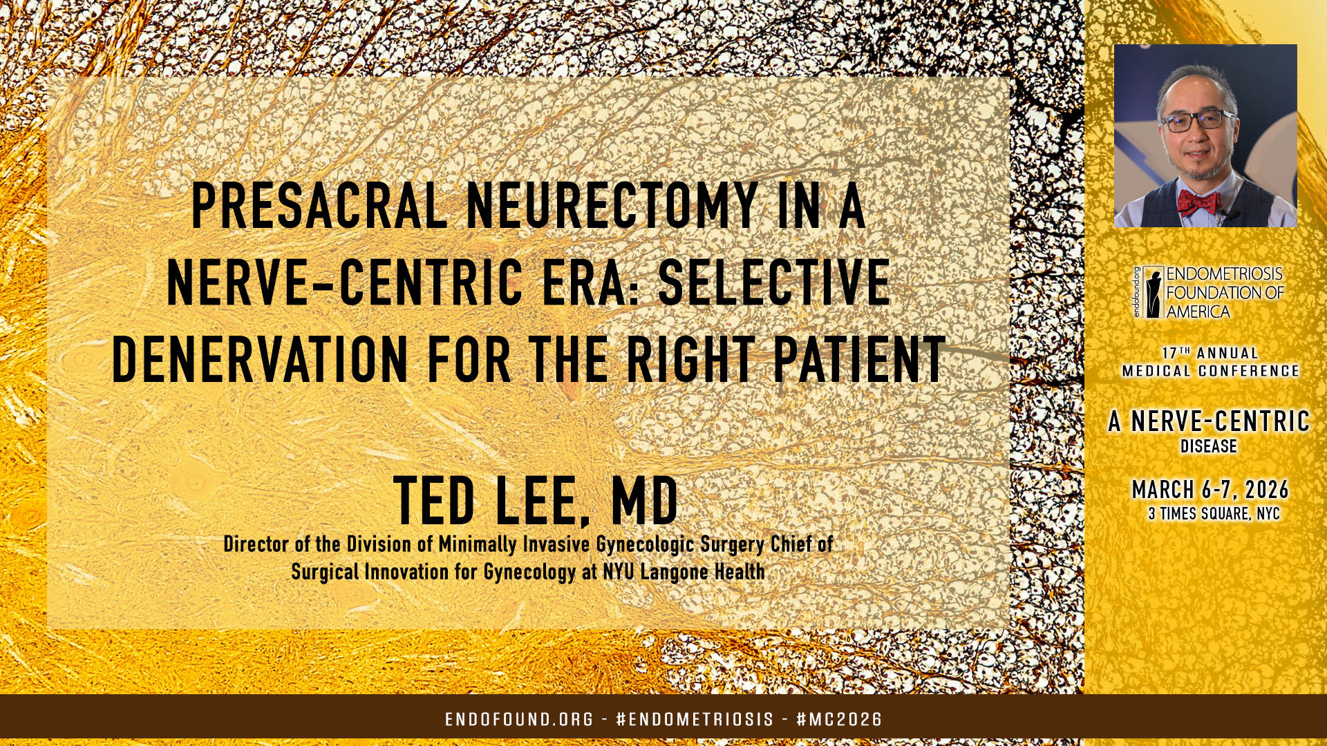 Ted Lee, MD - Presacral Neurectomy In A Nerve?Centric Era: Selective D ...